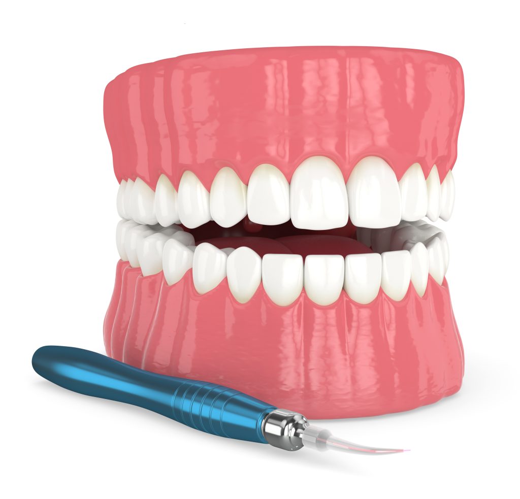 Frenectomy Chandler, AZ | Provinces Dental